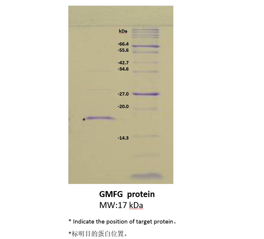 神经胶质成熟因子-Υ(GMFG)-ProtTech Inc.